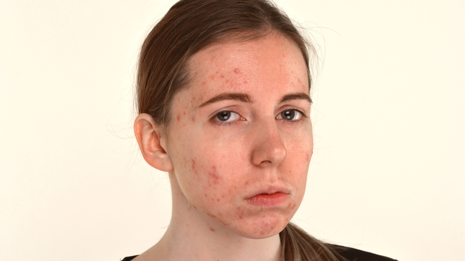 A Transgender Woman Realized She Was Intersex, Only After Seeking ...